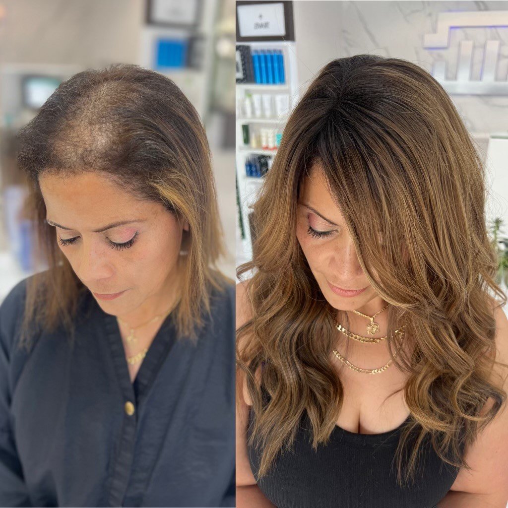 Human Hair Toppers for Long Wear | Monaco in Tampa